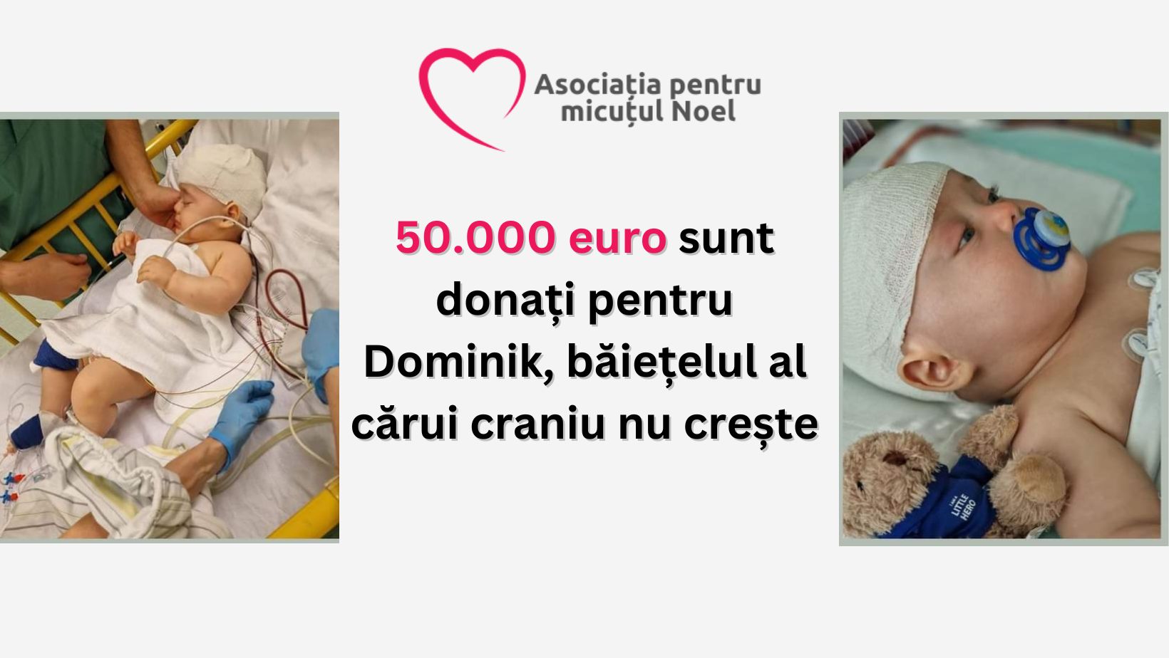 50.000 euro sunt donați pentru Dominik, băiețelul al cărui craniu nu ...